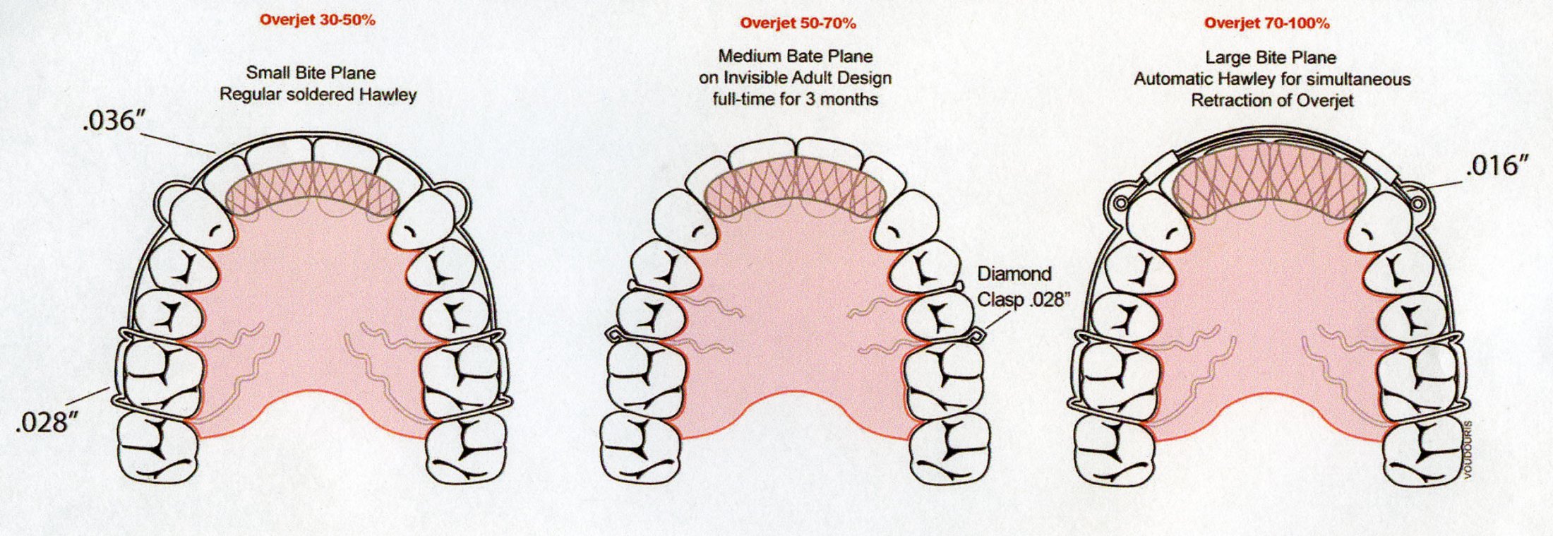 N Toronto ON, Innovative Orthodontics