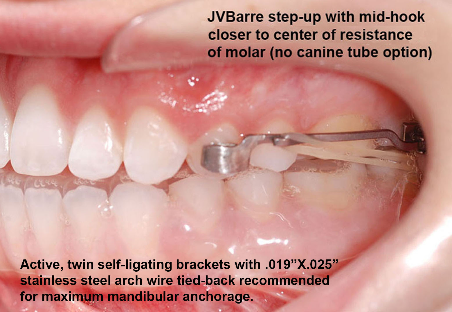 JVB Toronto ON, Innovative Orthodontics