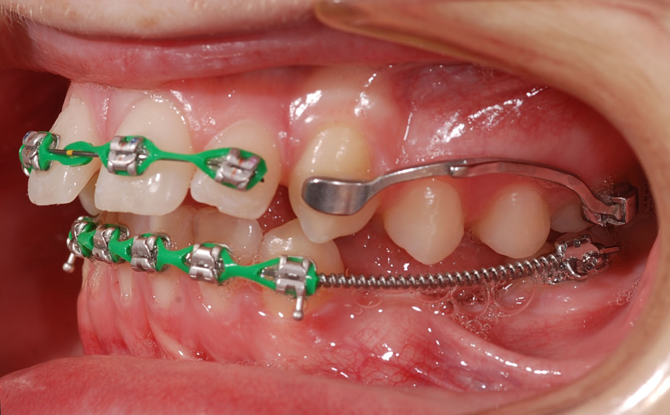 JVB Toronto ON, Innovative Orthodontics